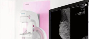 Siemens Mammography Systems | High-Quality Breast Imaging